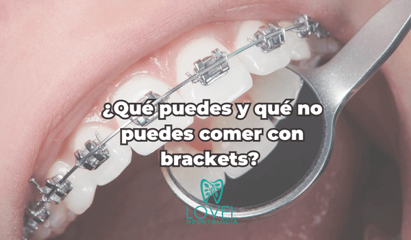 ¿Qué puedes y qué no puedes comer con brackets?